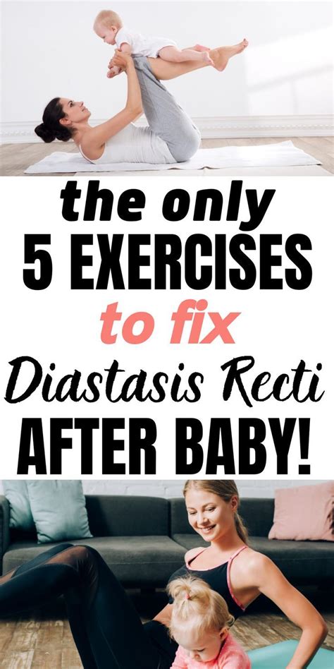 The Top 5 Exercises To Heal Diastasis Recti After Pregnancy