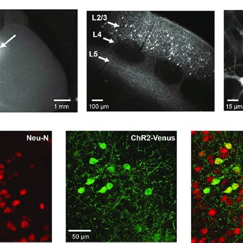 Chr2 Expression In L2 3 Pyramidal Neurons Following In Utero