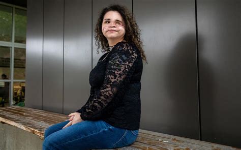Michigan Woman Shot In Face By Stepdad Is Haunted In Dreams Tortured