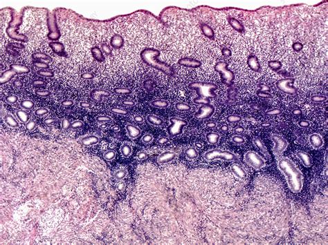 Human Uterus Light Micrograph Stock Image C055 6355 Science Photo Library