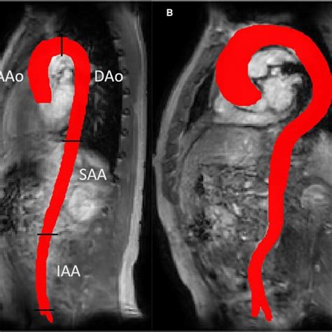 3d Aortic Segmentations For A Representative Young Subject Panel A Download Scientific