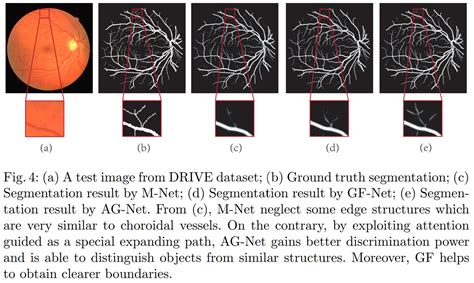Attention Guided Network For Retinal Image Segmentation 医療系aiエンジニアの技術メモ