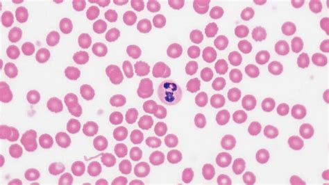 Upright Microscope Eclipse Ei Einst Technology Pte Ltd