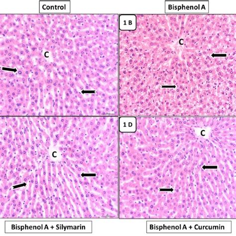 A The Liver Sections Of The Control Group Showed Normal Hepatic Download Scientific Diagram