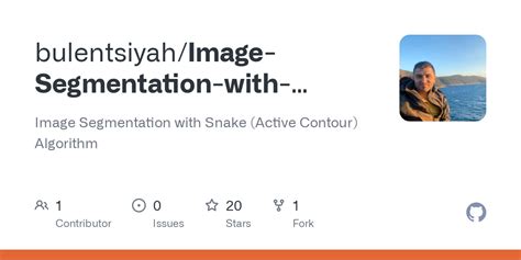 Github Bulentsiyahimage Segmentation With Snake Active Contour