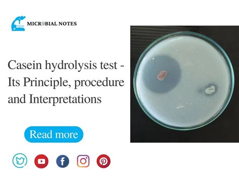 Casein Hydrolysis Test