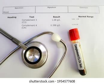 Blood Sample Tube Complement C3 C4 Stock Photo Edit Now 1954577608