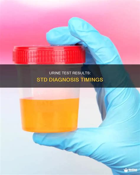 Urine Test Results Std Diagnosis Timings Medshun
