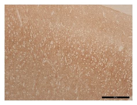 Photographs Of Synaptophysin Immunoreactivity In The Motor Cortex Download Scientific Diagram