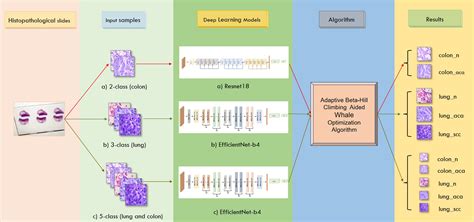 Github Raj 1411adbet Woa Adaptive Beta Hill Climbing Aided Whale Optimization Algorithm