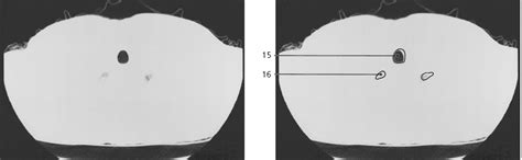 Ct Series Radiology Key
