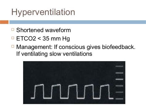 Etco2 In Non Intubated Patient A Must In Ed