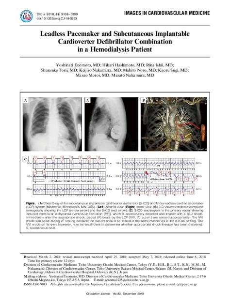 Pdf Leadless Pacemaker And Subcutaneous Implantable Cardioverter