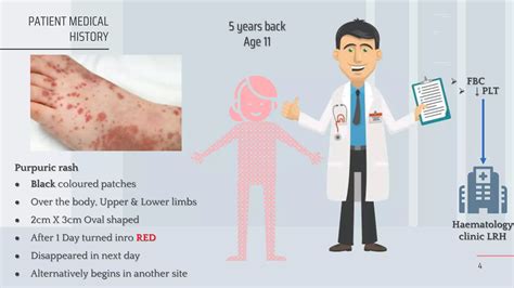Itp And Sle Clinical Case Presentation By Pamudith Karunaratne Ppsx