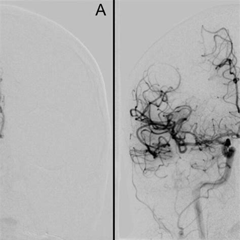 Diffusion Weighted Imaging Dwi And Fluid Attenuated Inversion Download Scientific Diagram