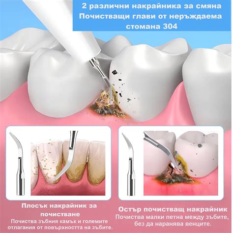 Ултразвуков уред за почистване на зъби Jup 231109 4 Ултразвуково почистване на зъбите
