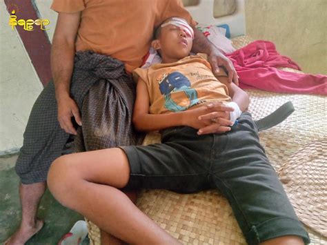 ကျောက်တော်မြို့ကို စစ်ကောင်စီ ဗုံးကြဲမှုကြောင့် အရပ်သားတစ်ဦးသေ၊ ၂၁ ဦးဒဏ်ရာရ