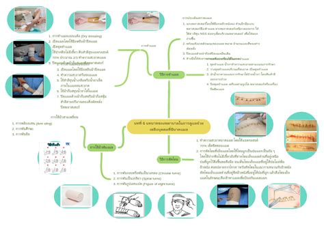 บทที่ 6 บทบาทของพยาบาลในการดูแลช่วยเหลือบุคคลที่มีบาดแผล Image Image