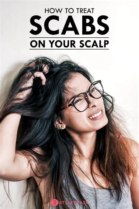How To Treat Scabs On The Scalp Artofit How To Treat Scabs On The Scalp Artofit