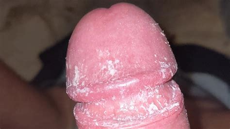 Smegma Steaming Smegma Thisvid Com