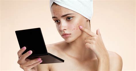 Cel Mai Bun Tratament Pentru Acnee Este Cel Personalizat Afla Cum Poti