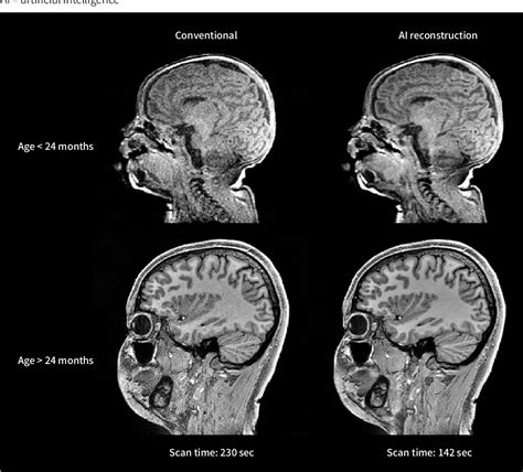 Figure 1 From [applications Of Artificial Intelligence In Mr Image Acquisition And