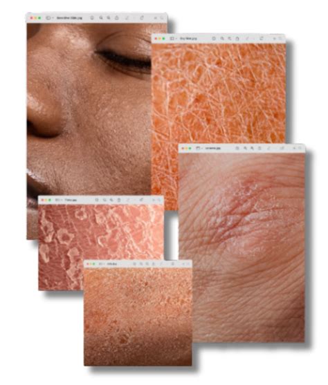 Skin Barrier Repair Causes Signs And How To Heal Safely Dot3b