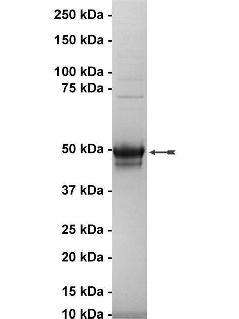 Eurofins Discoverx Igf Ir 1 958 Protein Active Quantity 20 μg