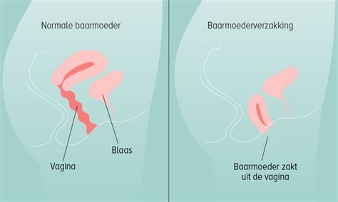 Hoe Lang Duurt Het Herstel Na De Bevalling Chuyengiaythethao Com