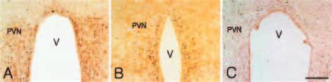 Differences Of Npy Ir In The Paraventricular Nucleus Pvn Npy Ir Was Download Scientific