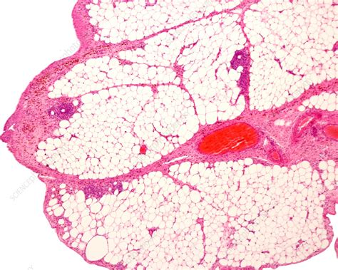 White Adipose Tissue Light Micrograph Stock Image C0576731 Science Photo Library