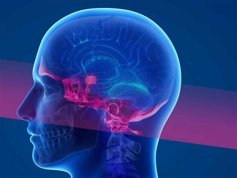 تومور قاعده جمجمه دکتر گیو شریفی