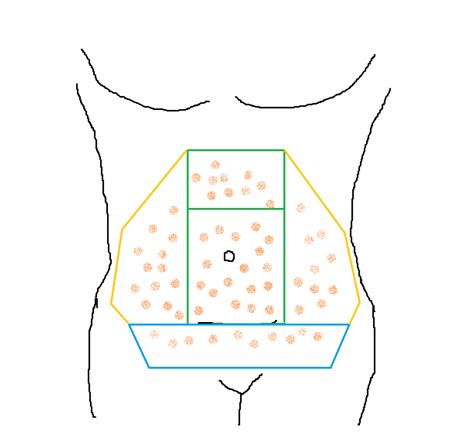 TAP Block Pain Evaluation
