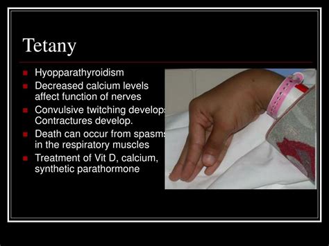 Ppt Endocrine System Powerpoint Presentation Free Download Id4159705