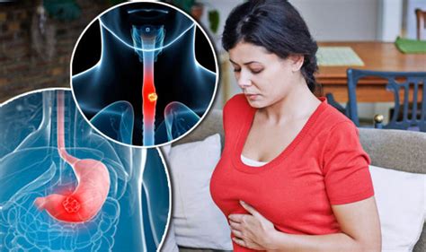Acid Reflux Throat Cancer Symptoms ~ Acid Reflux Disease Symptoms