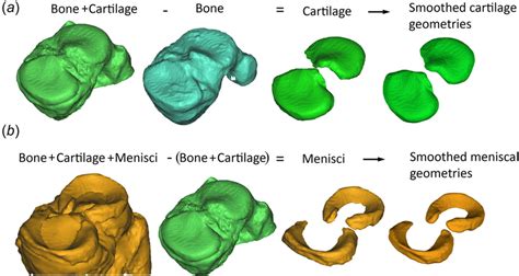 Boolean Subtraction Was Used To Develop 3d Geometries Of A The Tibial