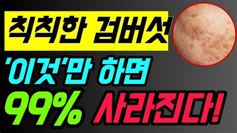 피부과 헛돈 쓰지 마세요 집에서 검버섯 없애는 방법 3가지 1탄 Youtube