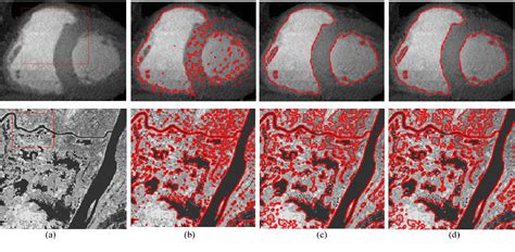 Figure 1 From A Novel Active Contour Model Guided By Global And Local Signed Energy Based