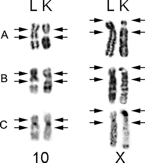 Chromosome Staining Plos One