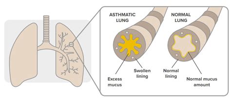 Frequently Diagnosed Conditions Mesi Simplifying Diagnostics