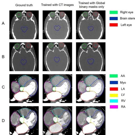 Qualitative Comparison Of The Predicted Contour By The Proposed Download Scientific Diagram