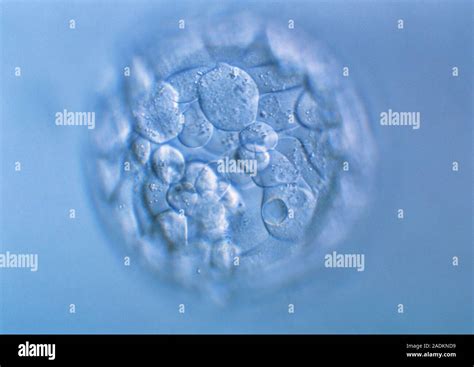 Blastocyst Embryo Light Micrograph Of A Human Embryo At The Blastocyst Stage This Early