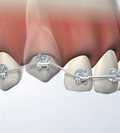 Our Services Greenhill Periodontics And Implants