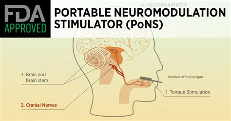 Novel Device Okd To Treat Ms Gait Deficits Medpage Today