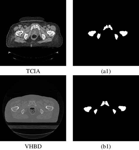 Figure 1 From Boosting Segmentation Performance Across Datasets Using Histogram Specification