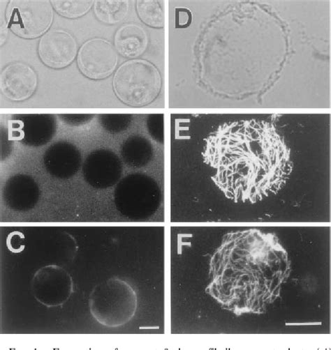 Figure 1 From In Situ Synthesis Of β Glucan Microfibrils On Tobacco Plasma Membrane Sheets