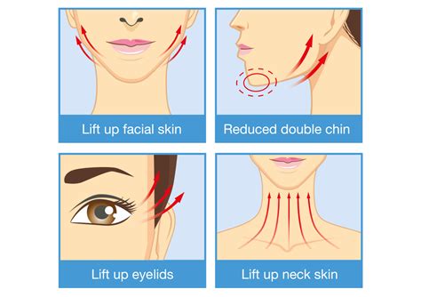 Dermalift Microface Intense Silhouette Dermalift