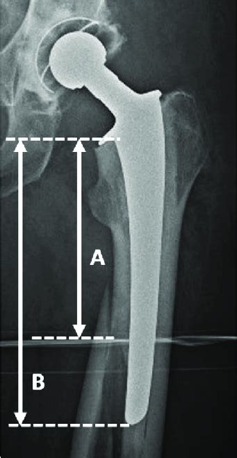 The Remaining Attachment Index Rai Is The Ratio Of The Proximal Download Scientific Diagram