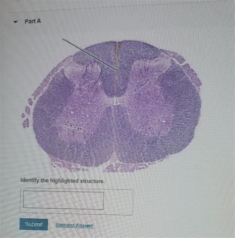 Solved Identify The Highlighted Structures Identify The