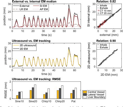 Figure 1 From Elpha Dynamically Deformable Liver Phantom For Real‐time Motion‐adaptive